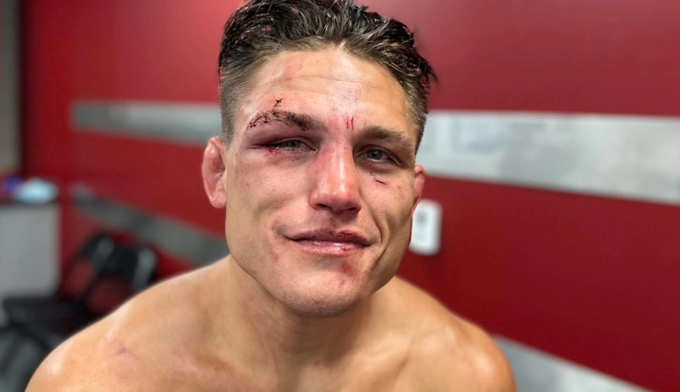 Drew Dober issues statement following TKO loss to Jean Silva at UFC ...