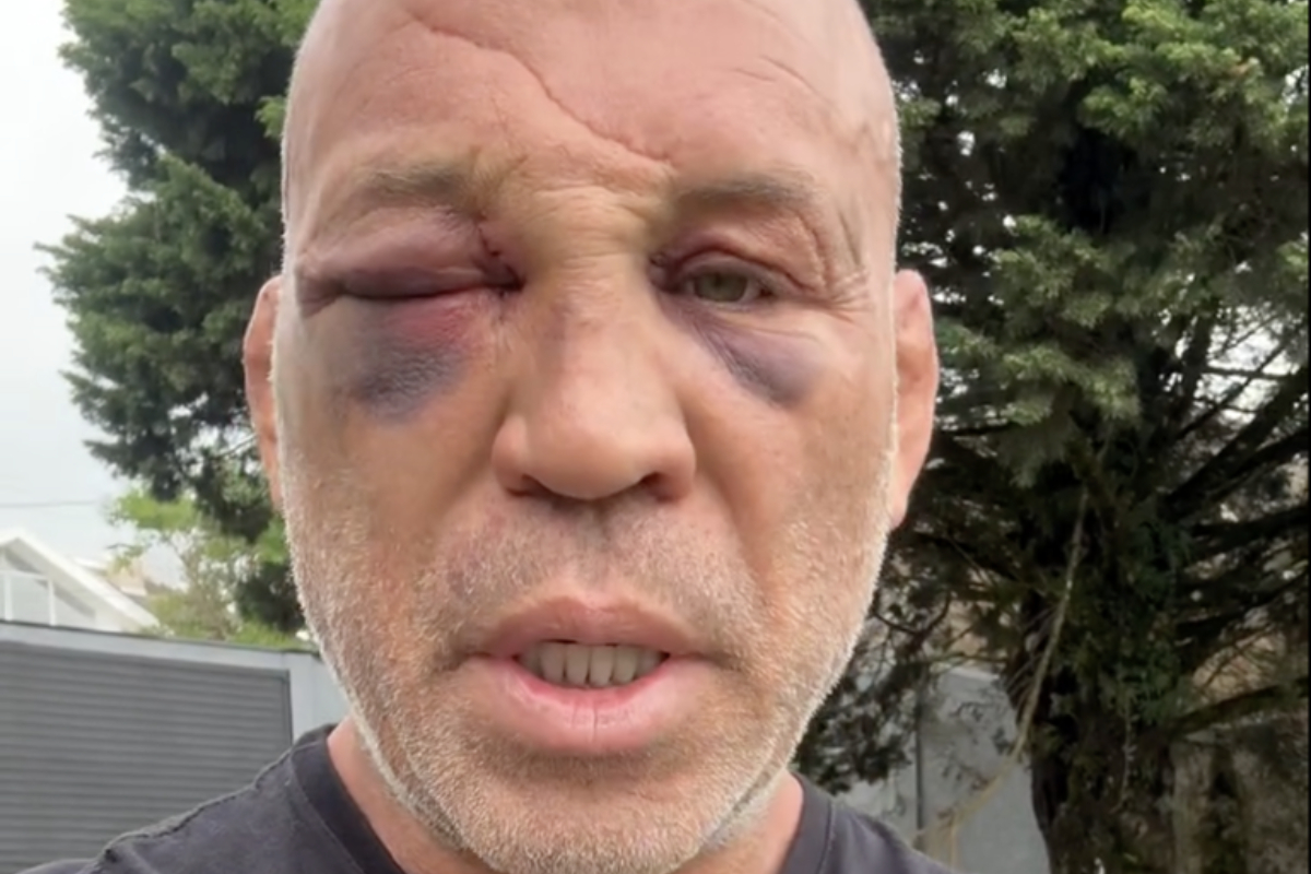 Former UFC champion blames Wanderlei Silva for post-fight incident that ...